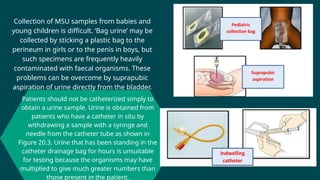 Laboratory diagnosis of UTI (Practical). | PPTX | Medical Tests ...