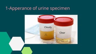 Laboratory diagnosis of UTI (Practical). | PPTX