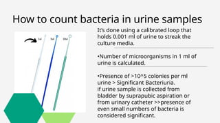 Laboratory diagnosis of UTI (Practical). | PPTX