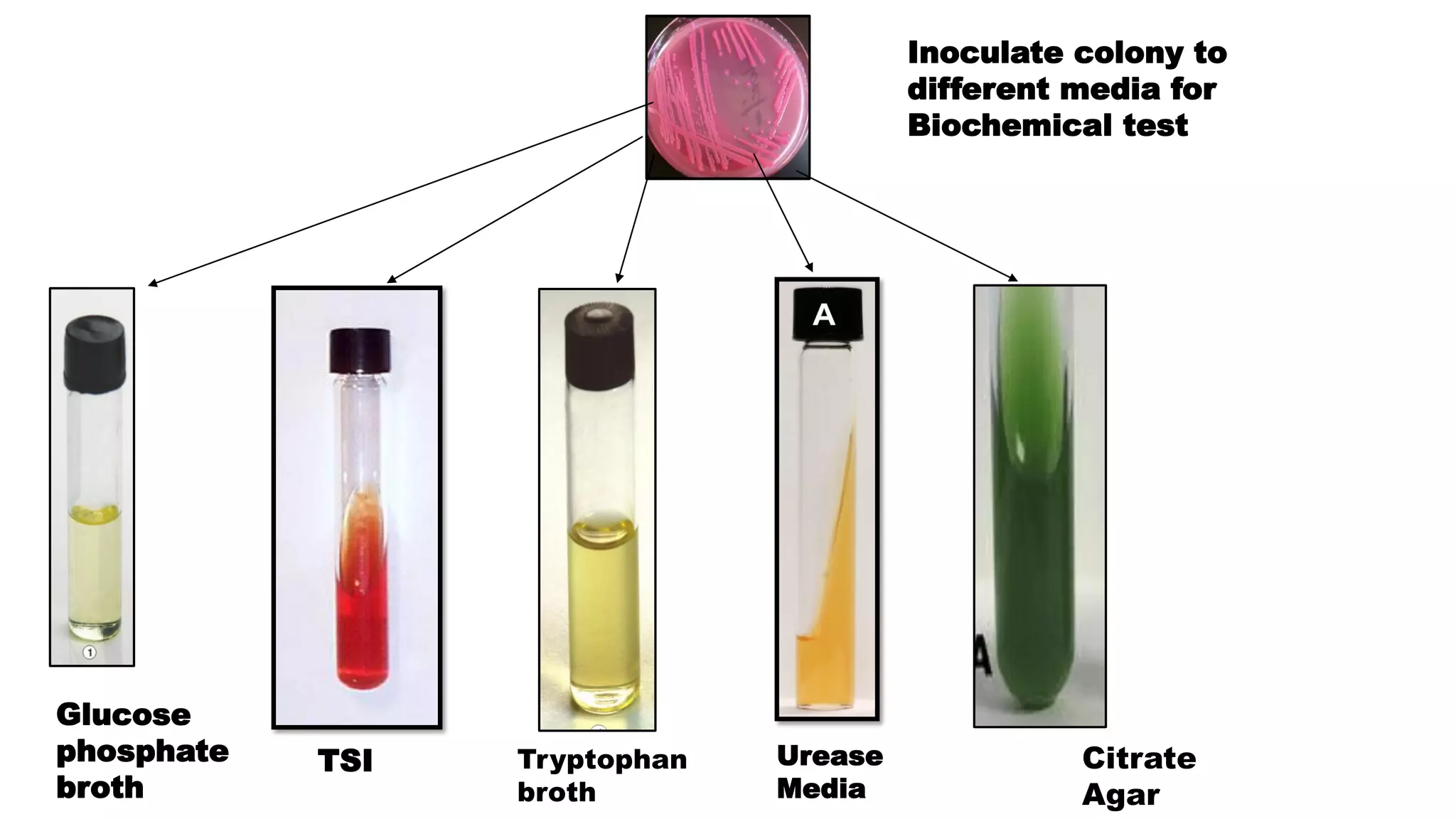 Uti diagnosis with pic microbiology | PDF