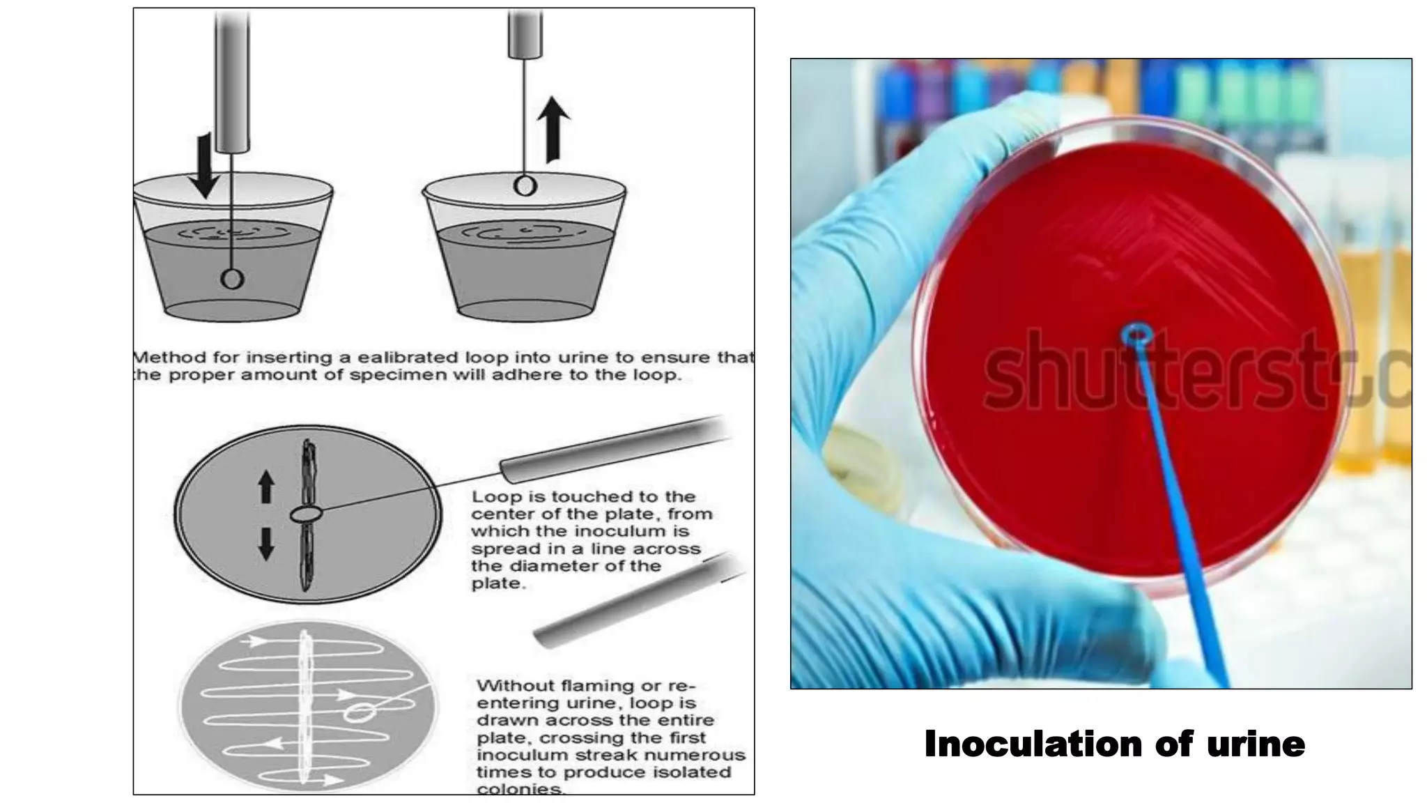 Uti diagnosis with pic microbiology | PDF