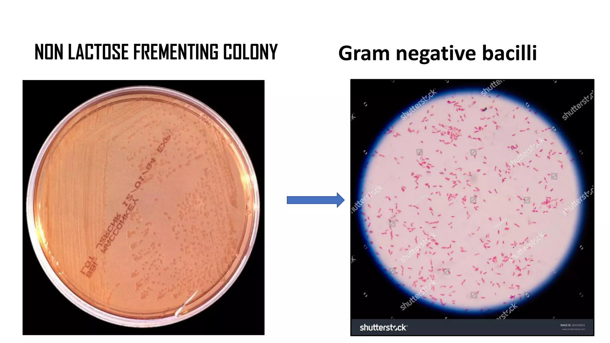 Uti diagnosis with pic microbiology | PDF