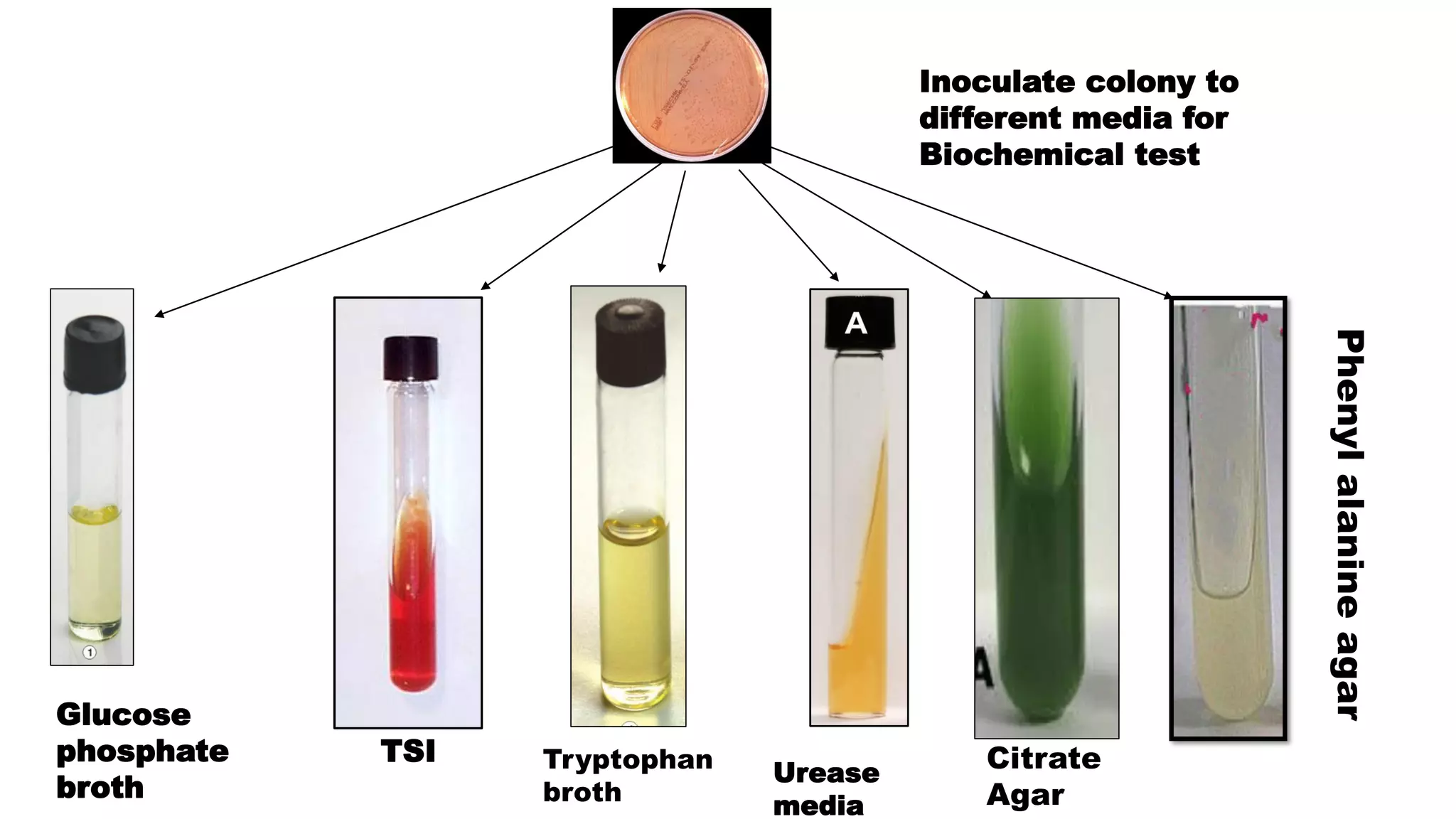 Uti diagnosis with pic microbiology | PDF