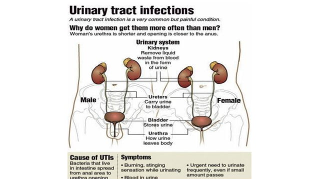 Uti diagnosis with pic microbiology | PDF | Infectious Diseases ...