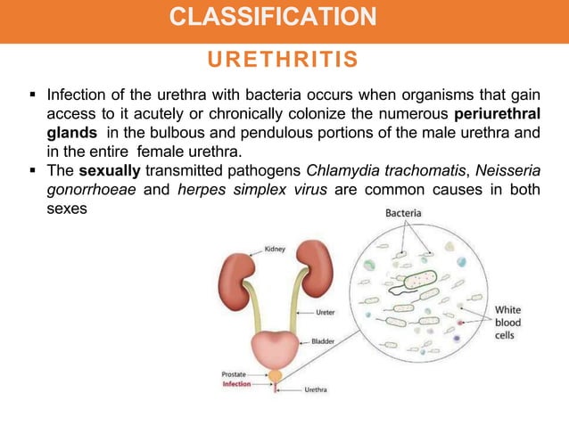UTI urinary tract infection final.pptx