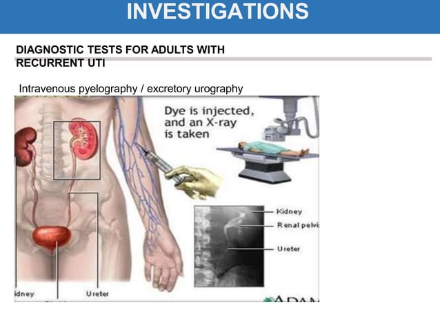 UTI urinary tract infection final.pptx