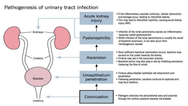 UTI infection.pptx,Pharmacology dept, .. | PPT