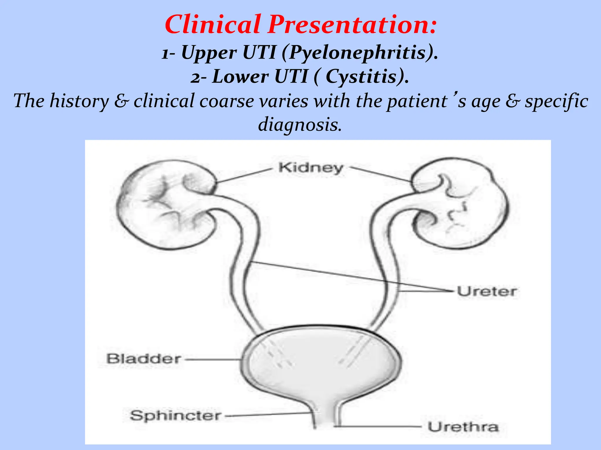 UTI in Pediatric age -How to Manage?.ppt
