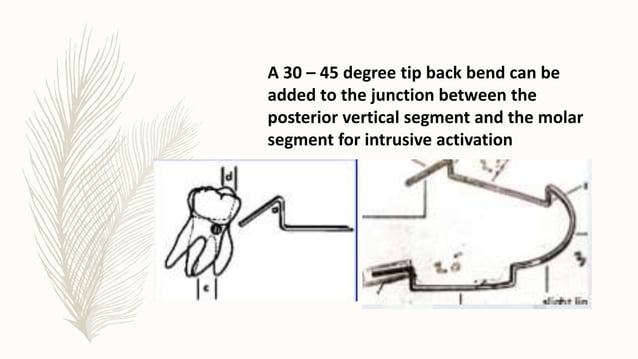 Utility arch | PPTX | Dental Health | Diseases and Conditions