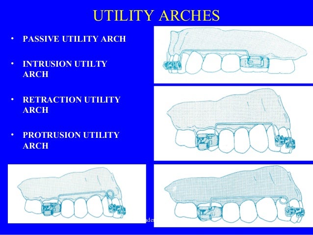 Utility arches