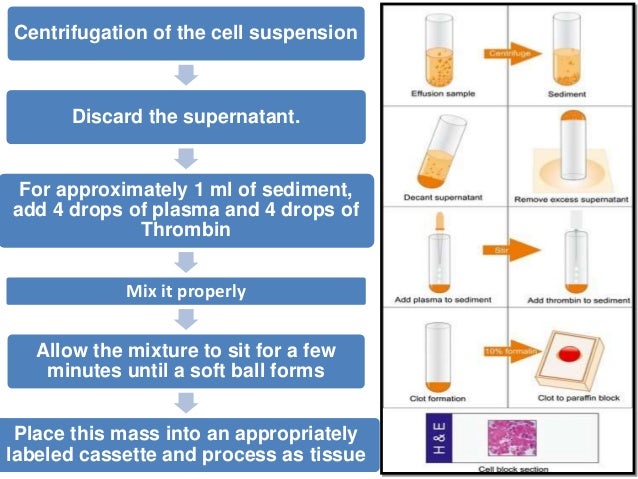 Utility of cell block in cytology.