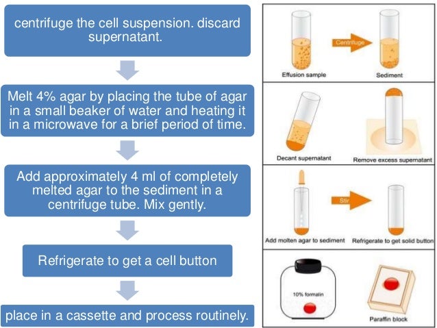 Utility of cell block in cytology.