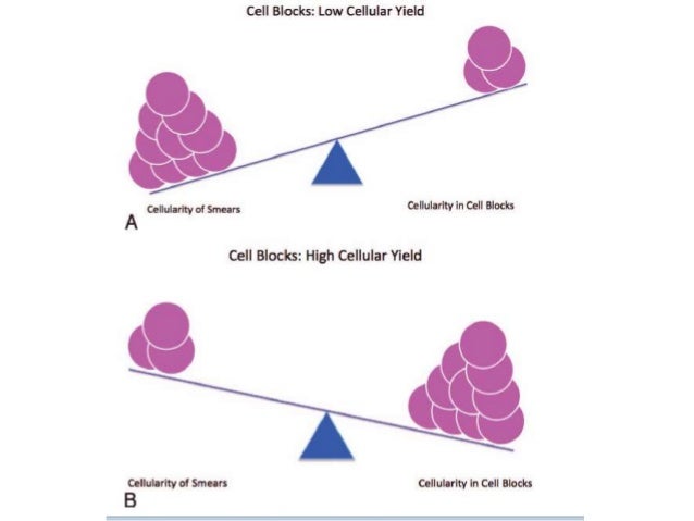 Utility of cell block in cytology.
