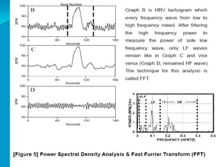 Utility value of tilt table testing in evaluation | PPT