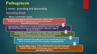 URINARY TRACT INFECTIOM | PPTX
