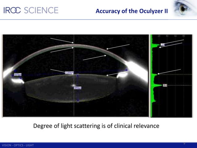 Utilizing topolyzer vario & oculyzer ii for accurate refractive | PPT