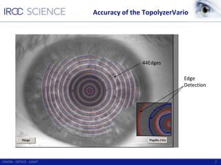 Utilizing topolyzer vario & oculyzer ii for accurate refractive ...