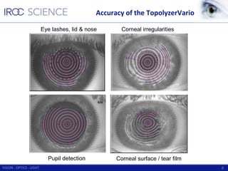 Utilizing topolyzer vario & oculyzer ii for accurate refractive ...