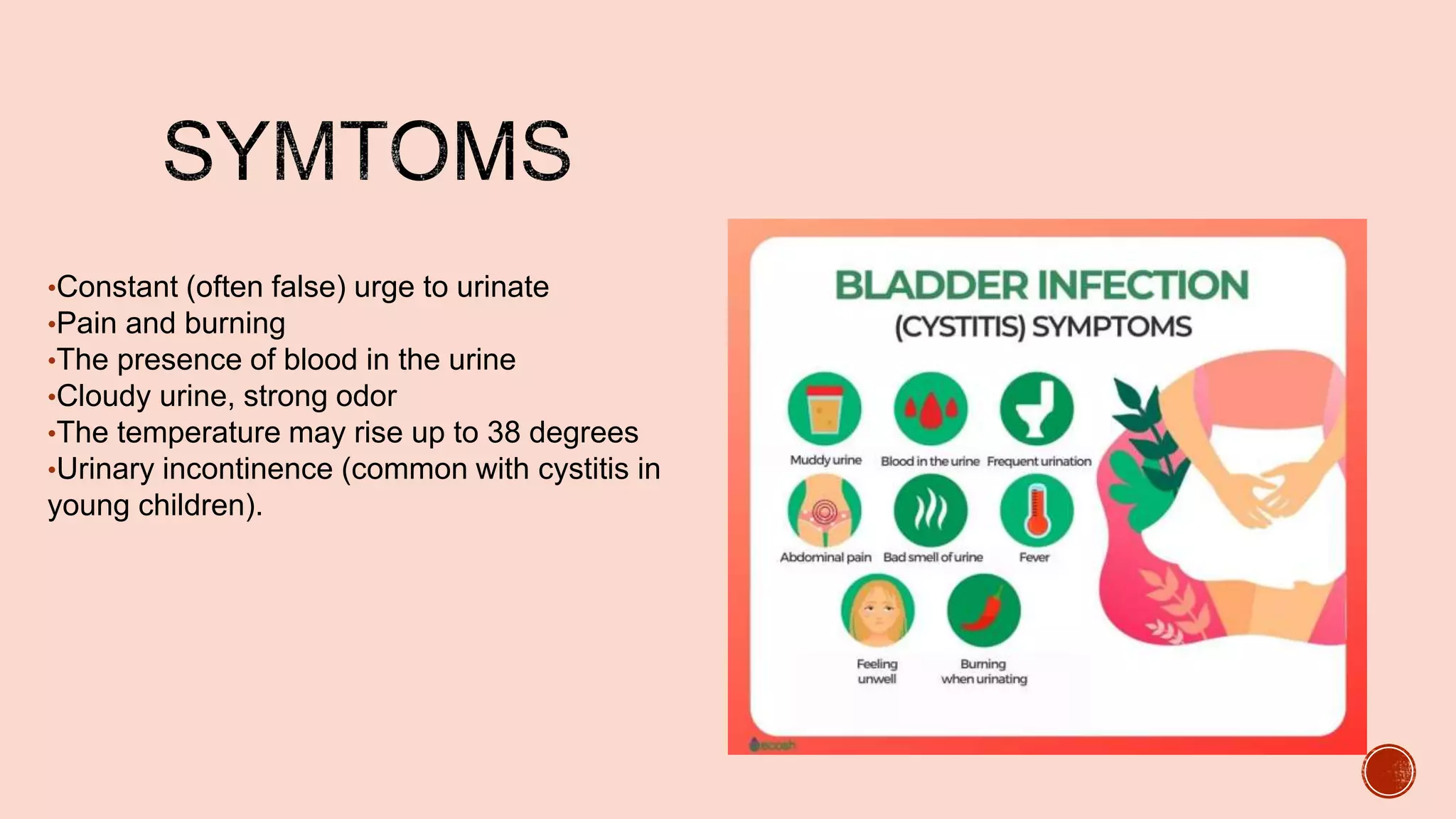 URINARY TRACT INFECTION IN CHILDREN | PPTX