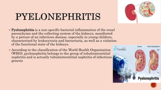 URINARY TRACT INFECTION IN CHILDREN | PPTX