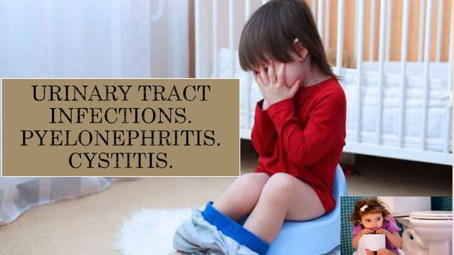 URINARY TRACT INFECTION IN CHILDREN | PPT
