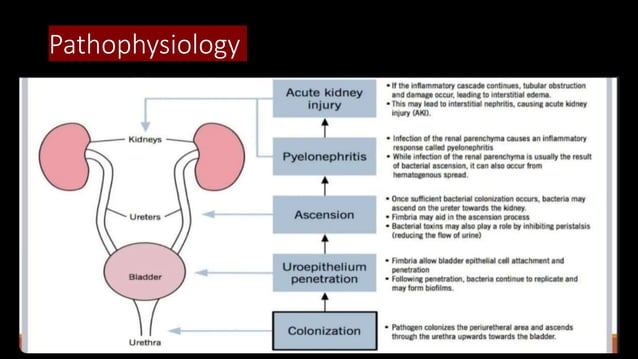 Urinary Tract Infection-1.pptx