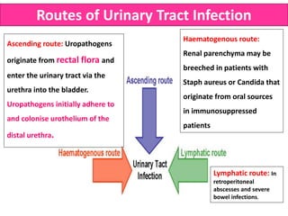 ABC of Uncomplicated Lower Urinary Tract Infection in women (PART -1 ...