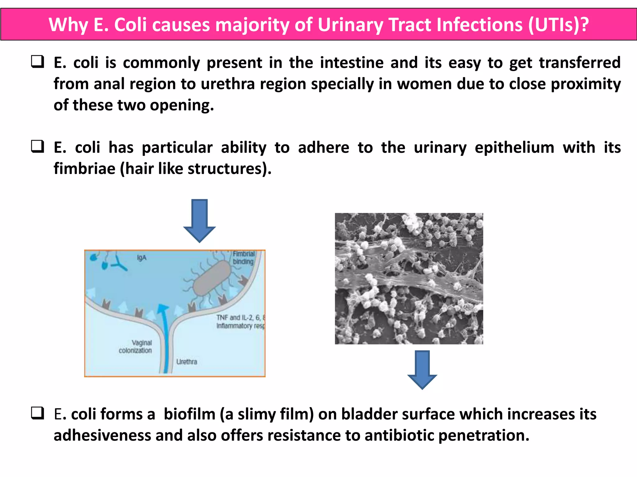 OVERVIEW of Uncomplicated Lower Urinary Tract Infection in women Dr ...