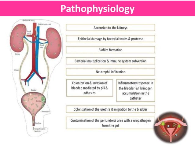 OVERVIEW of Uncomplicated Lower Urinary Tract Infection in women Dr ...