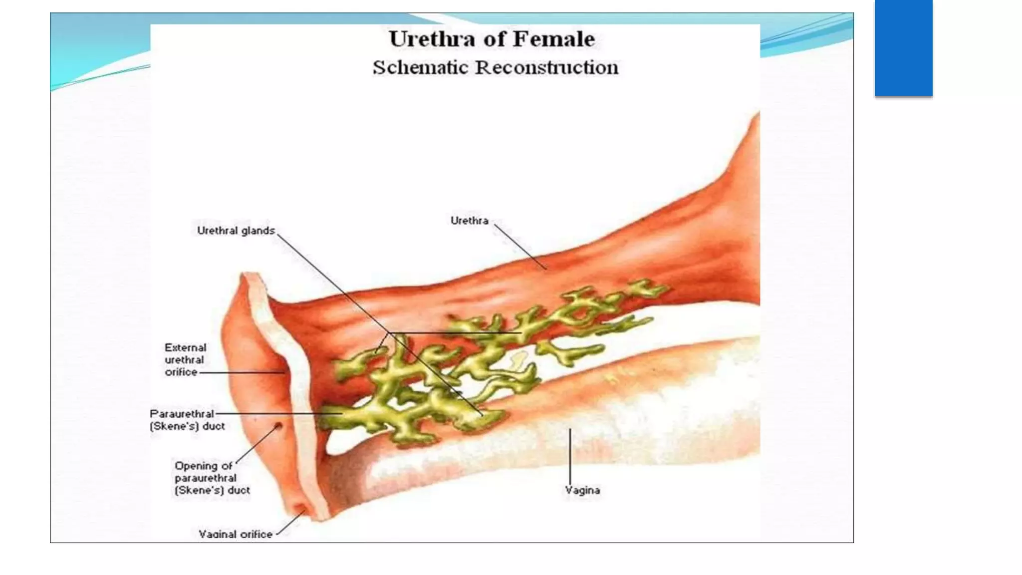 Urinary track infection | PPTX