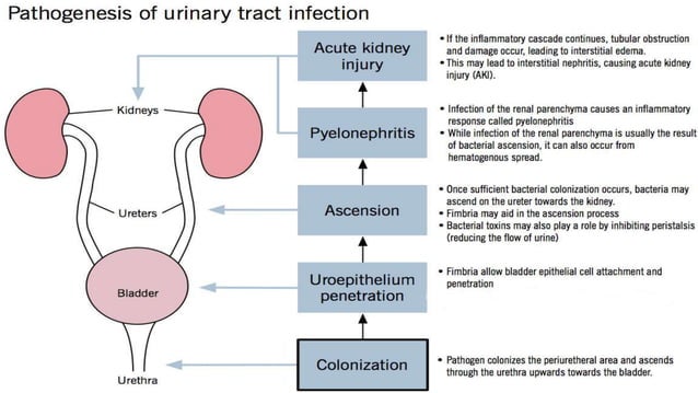 Urinary track infection | PPT
