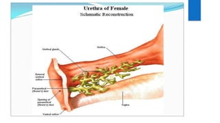 Urinary track infection | PPTX
