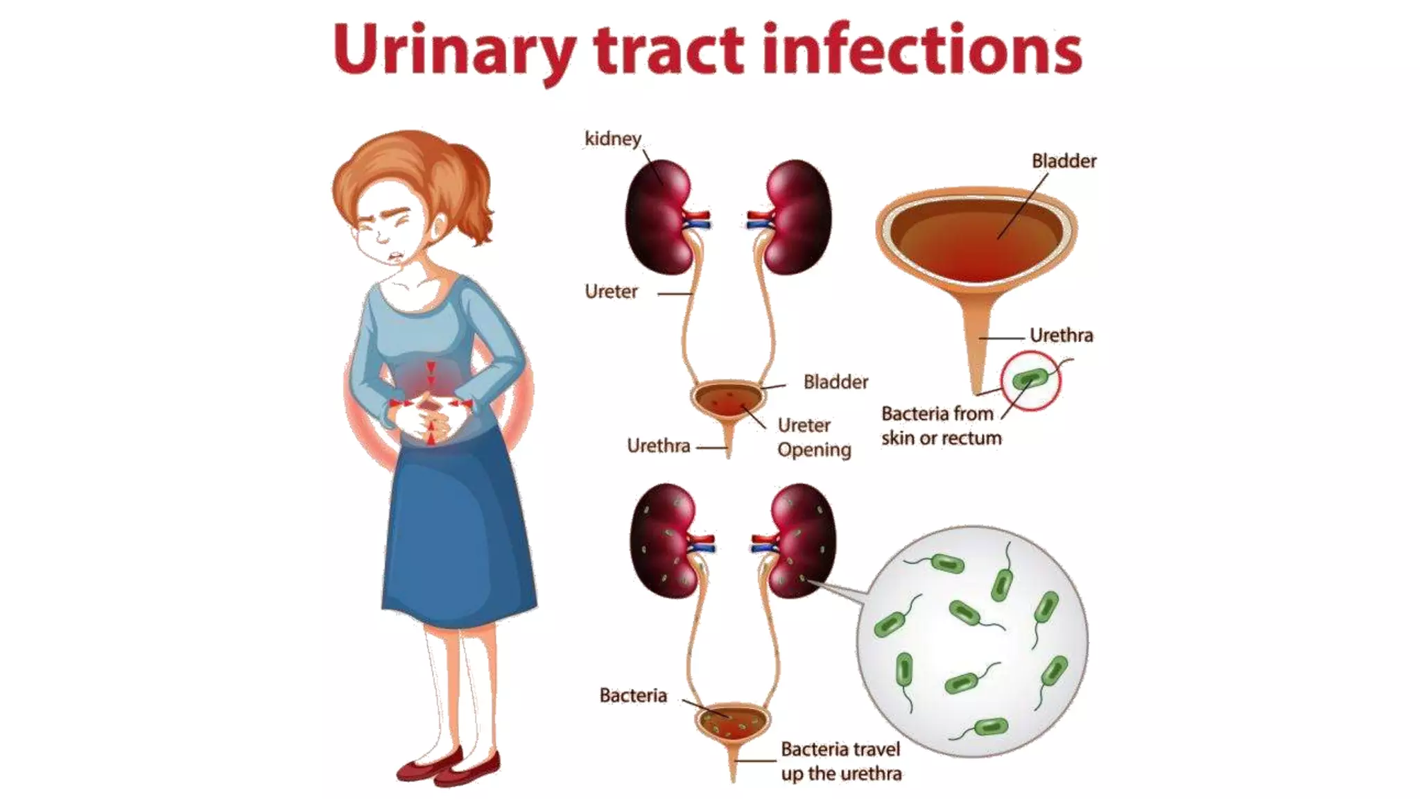 Urinary Tract Infection | PPT