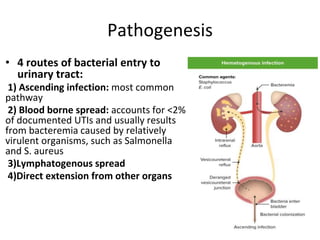 (UTI) presentation.pptx