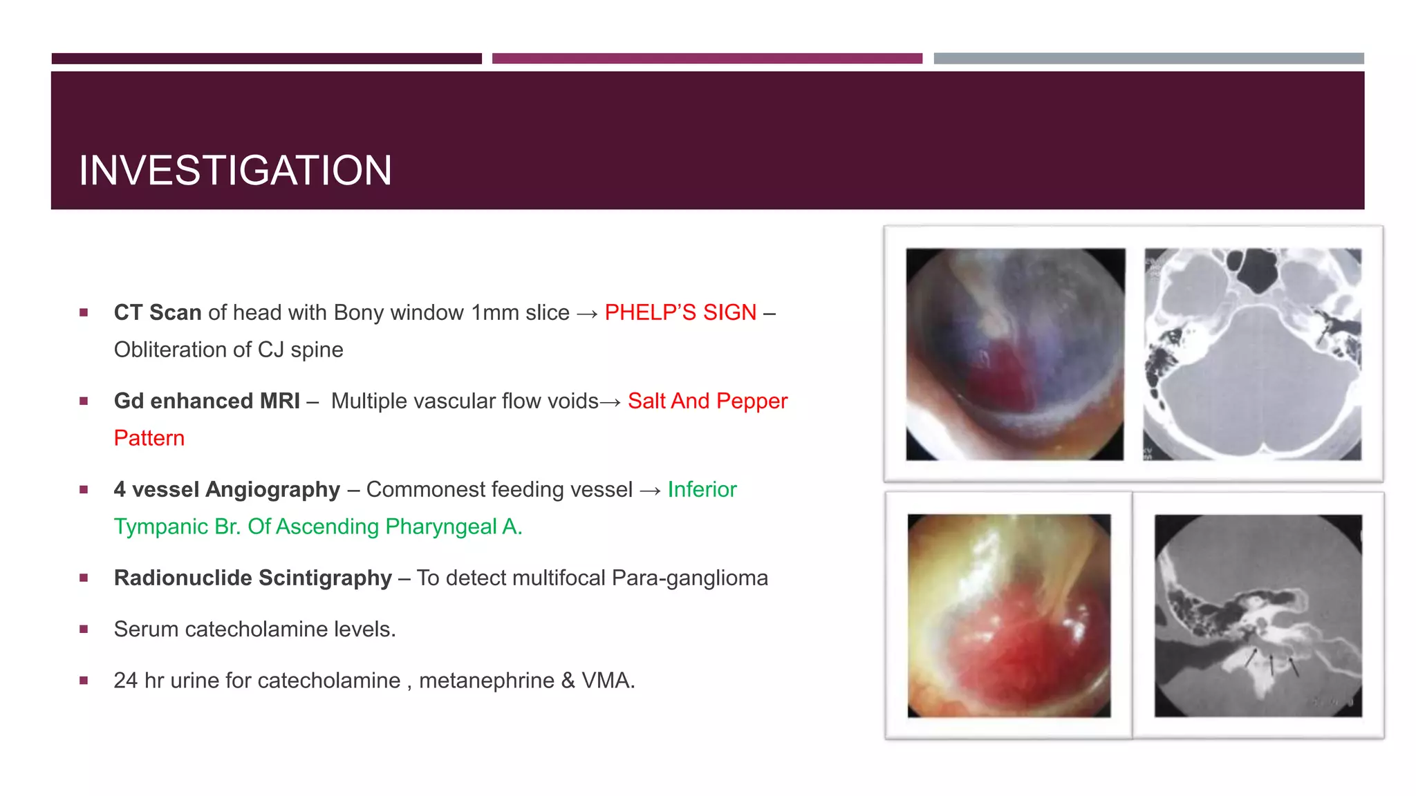 Glomus Tumour | PPSX