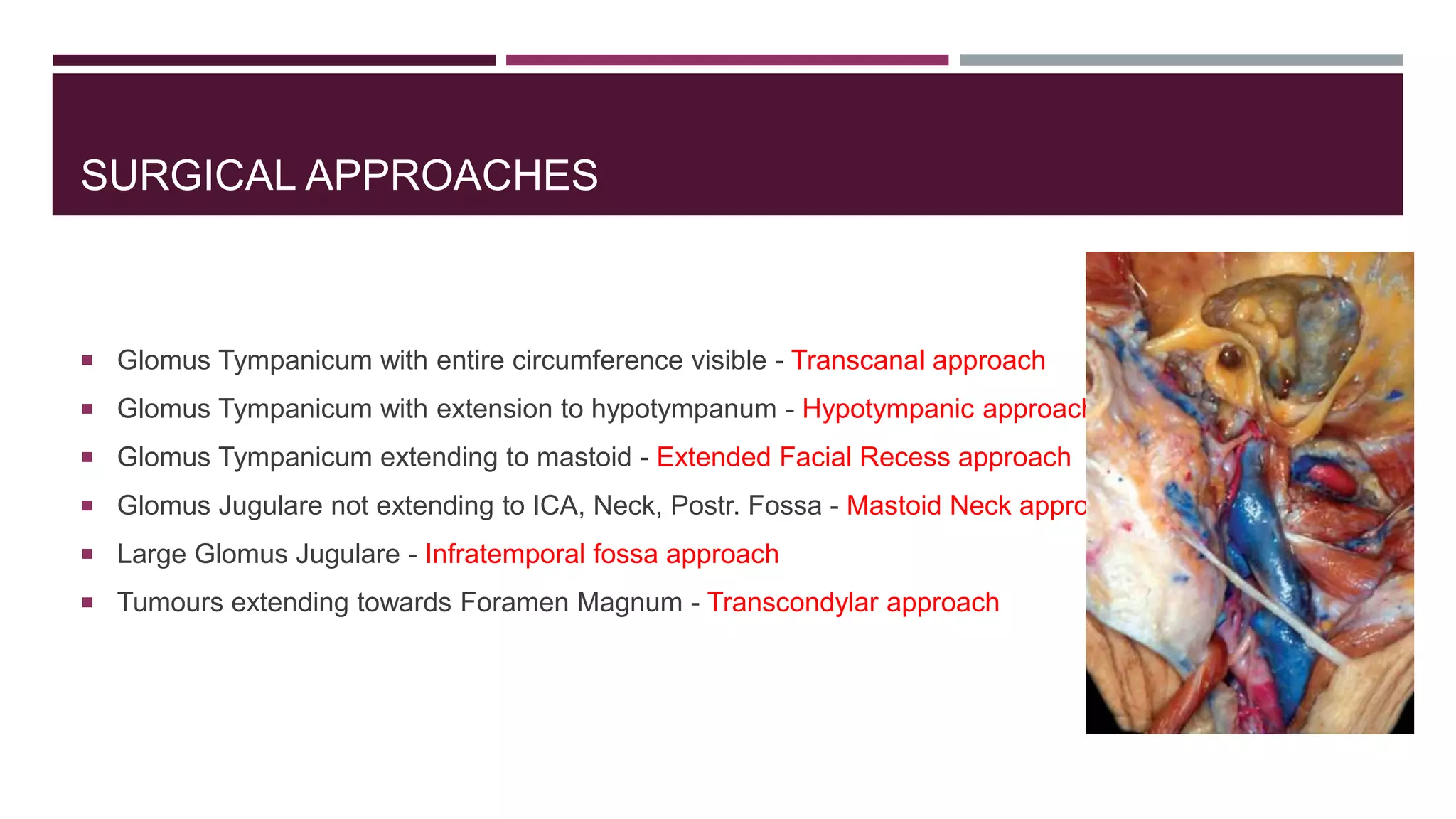 Glomus Tumour | PPSX