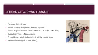 Glomus Tumour | PPSX