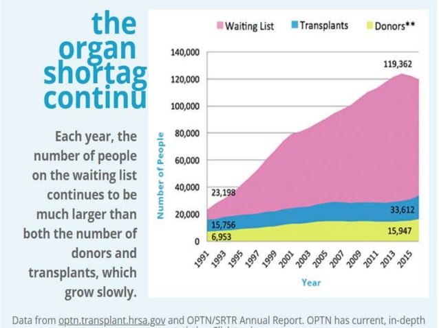 Uterus Transplantation Utx (obstetric and gynecology) | PPTX