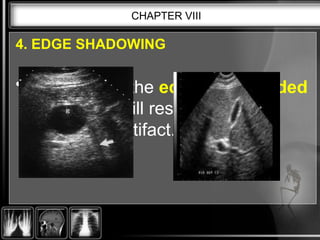 Ultrasound Artifacts_powerpoint presentation | PPTX