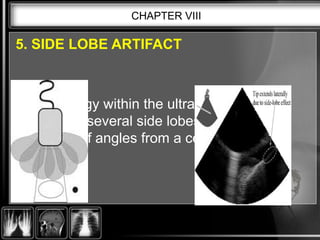 Ultrasound Artifacts_powerpoint presentation | PPTX