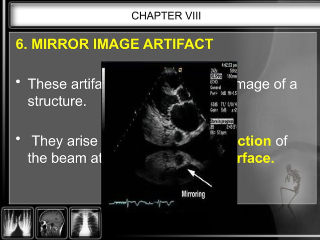 Ultrasound Artifacts_powerpoint presentation | PPTX