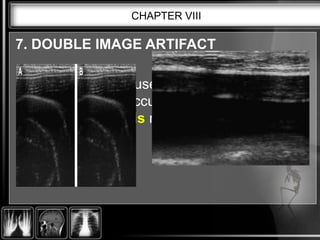 Ultrasound Artifacts_powerpoint presentation | PPTX