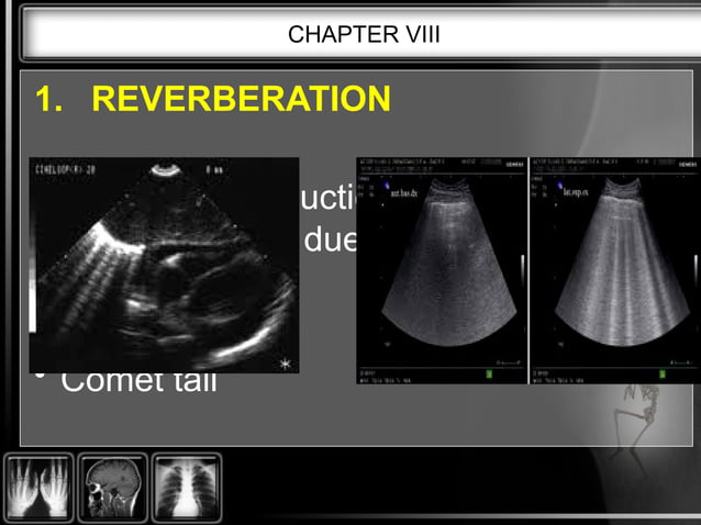 Ultrasound Artifacts_powerpoint presentation | PPTX