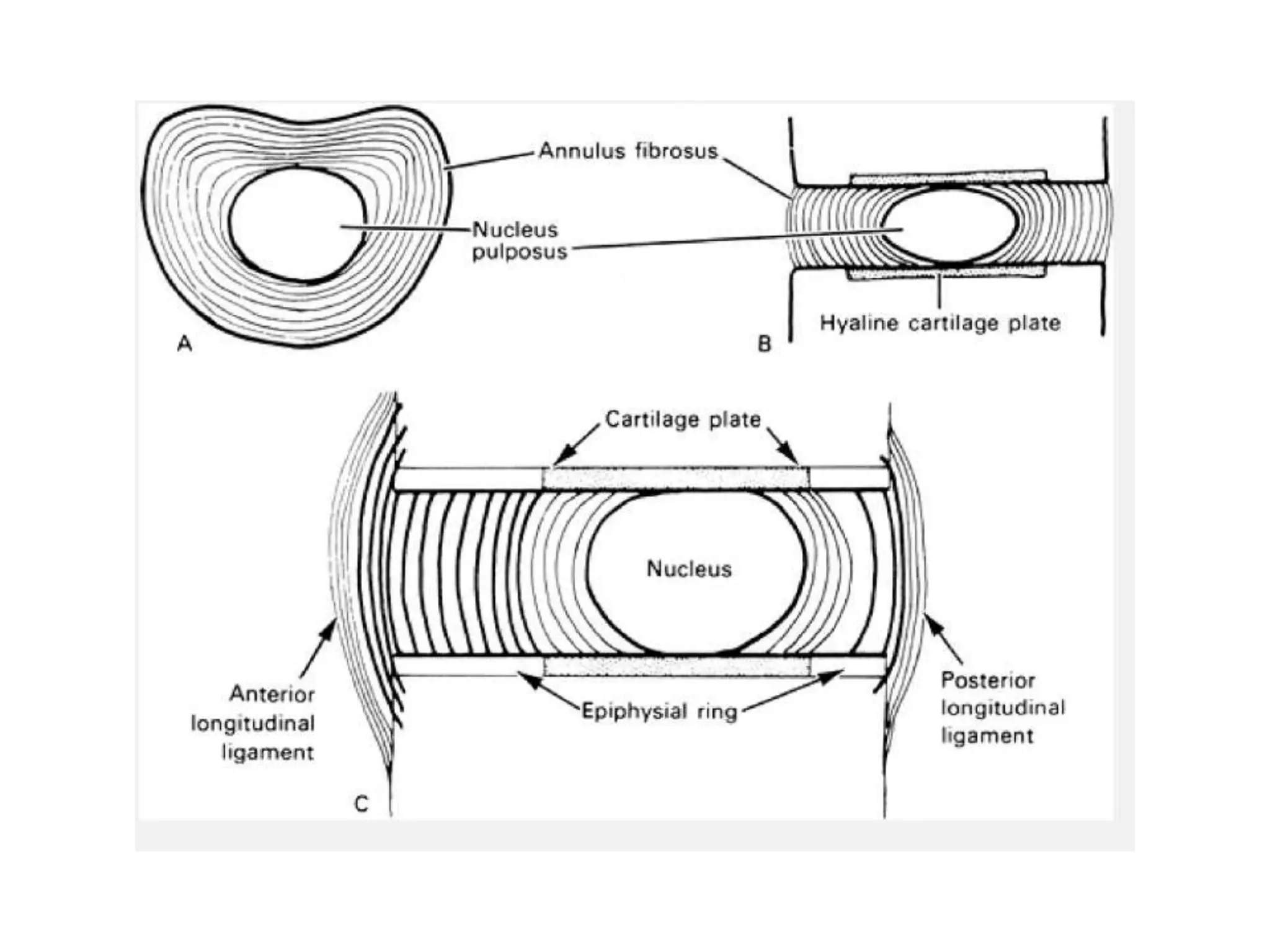 Lumbar intervertebral disc anatomy, biomechanics and pathogenesis of ...