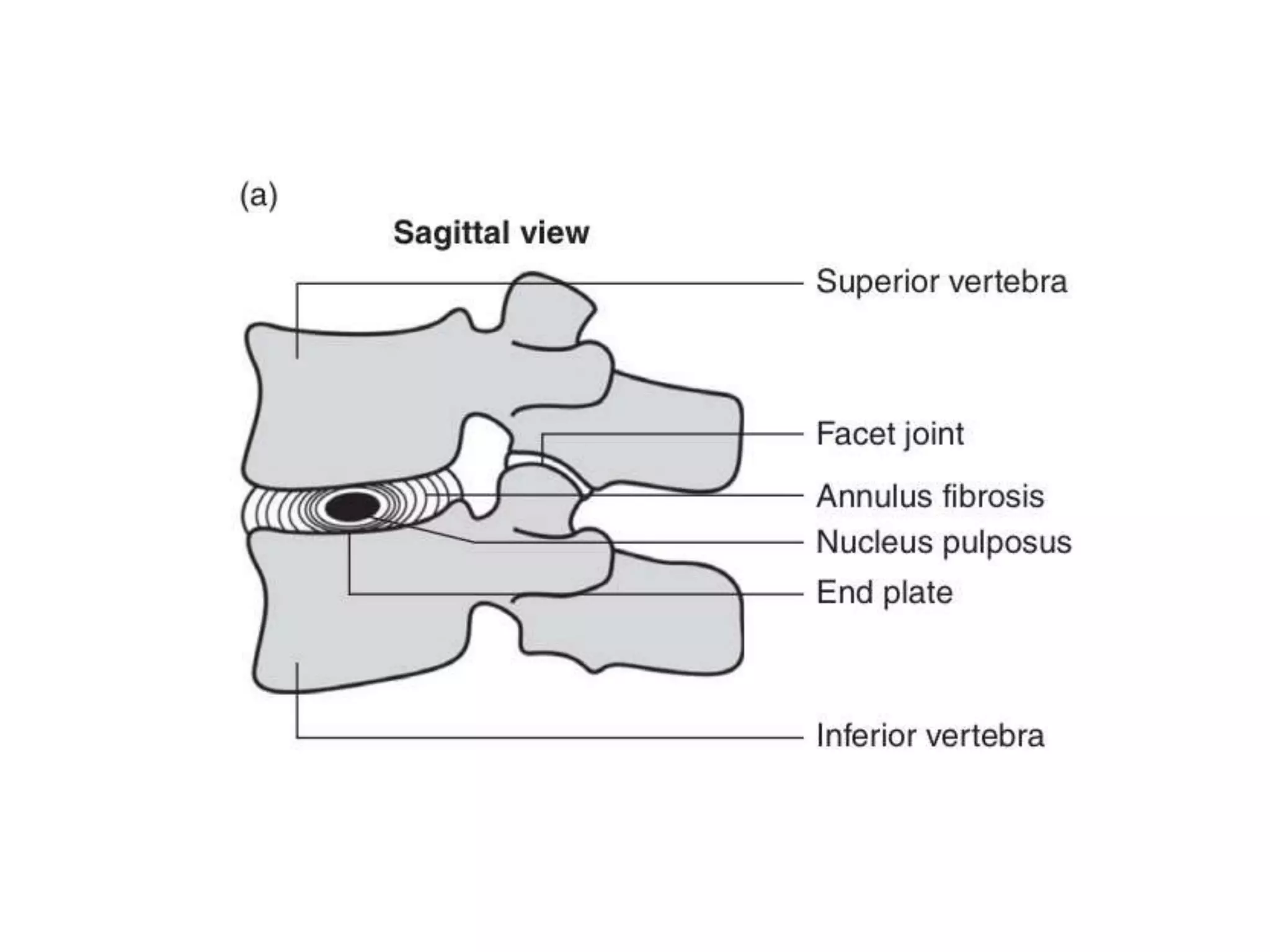 Lumbar intervertebral disc anatomy, biomechanics and pathogenesis of ...