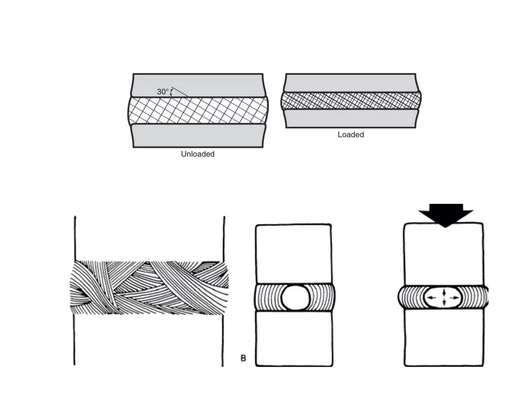 Lumbar intervertebral disc anatomy, biomechanics and pathogenesis of ...