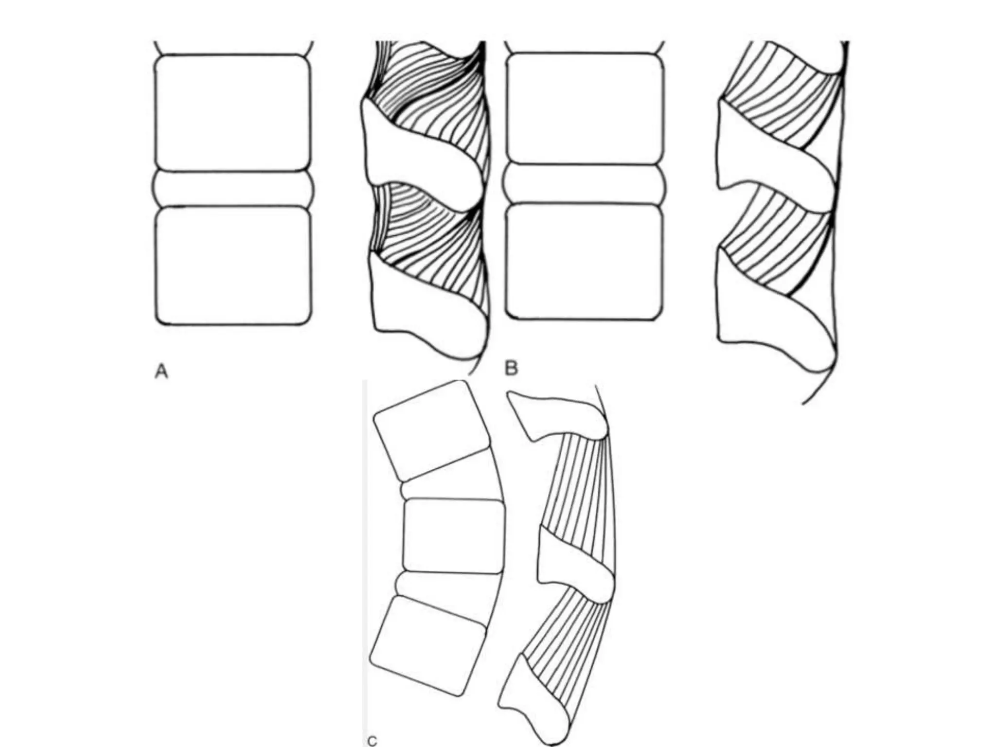 Lumbar intervertebral disc anatomy, biomechanics and pathogenesis of ...