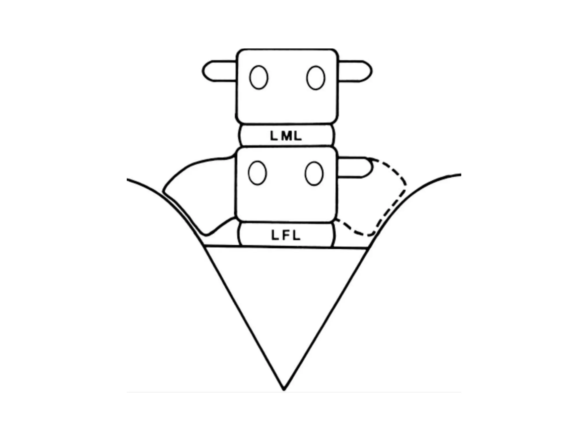 Lumbar intervertebral disc anatomy, biomechanics and pathogenesis of ...