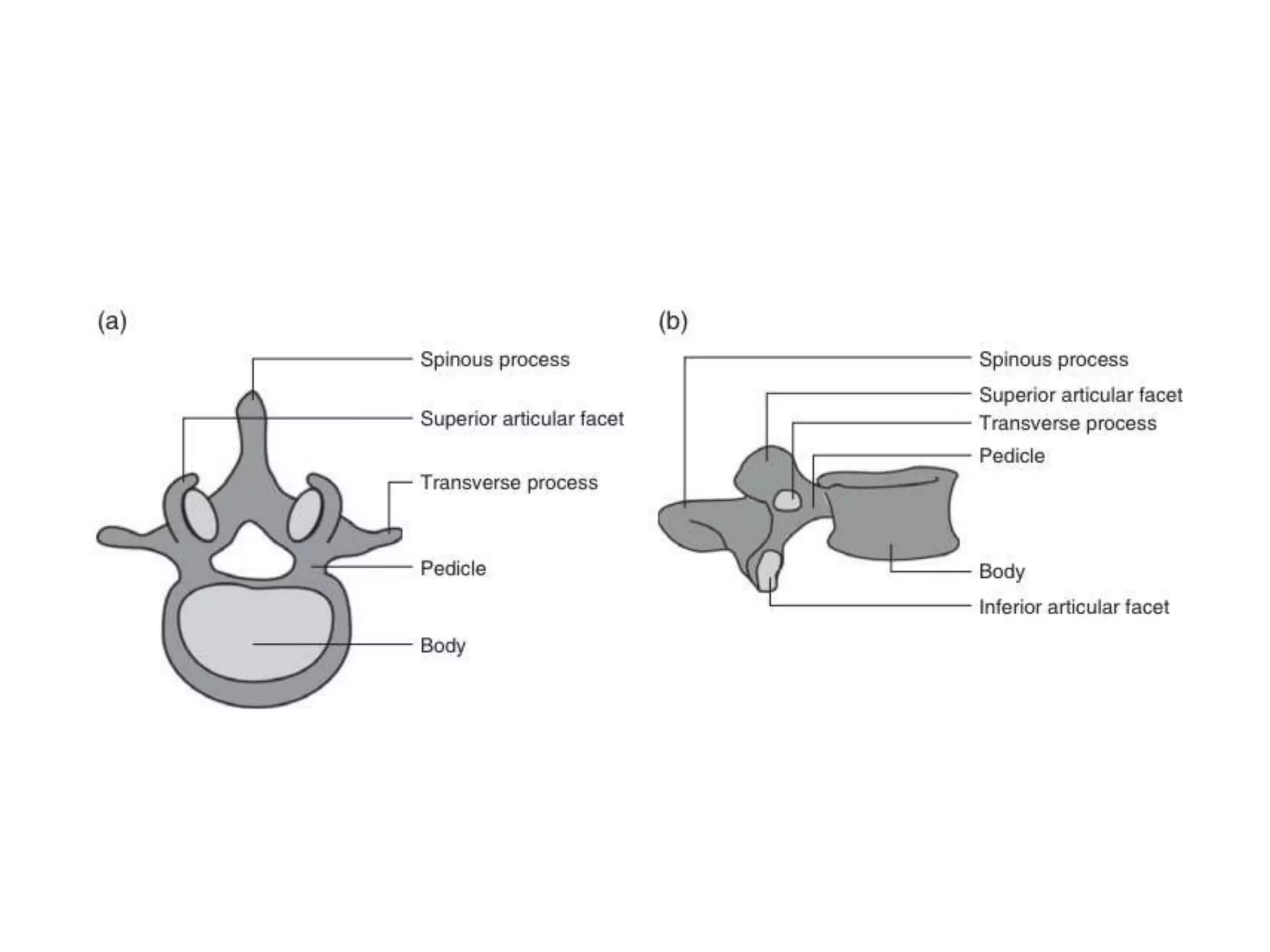 Lumbar intervertebral disc anatomy, biomechanics and pathogenesis of ...