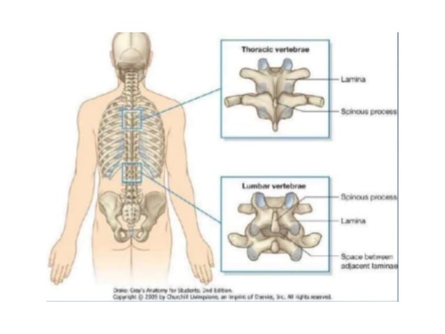 Lumbar intervertebral disc anatomy, biomechanics and pathogenesis of ...